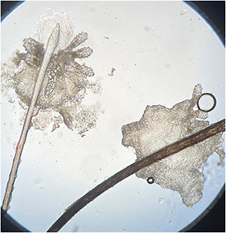 Corneal Physician | PentaVision