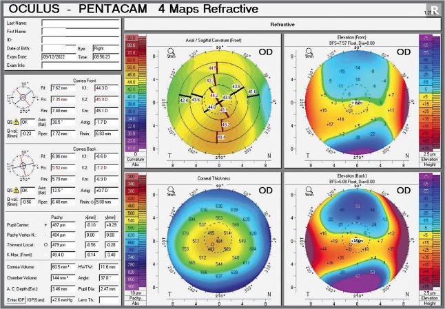Corneal Physician | PentaVision