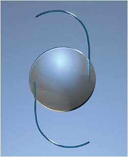 Implementing the Light Adjustable Lens in Practice | Corneal Physician